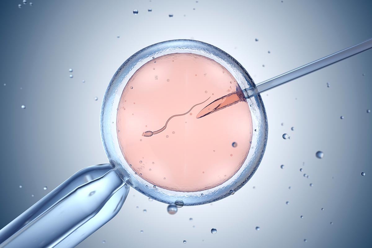 IUI Vs. IVF: What’s The Difference? A Doctor Explains - Majella Women's ...